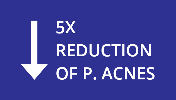 Alexis Orthopaedic Protector | Soft Tissue Protection