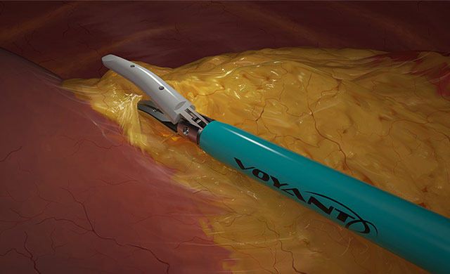 Voyant Intelligent Energy System | Applied Medical